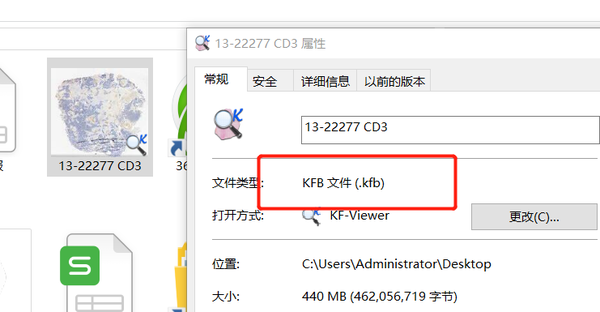 昨日依旧 的想法: 记一次kfb格式转换svs格式，简单高效 病理图片kfb转换svs格式 - 知乎