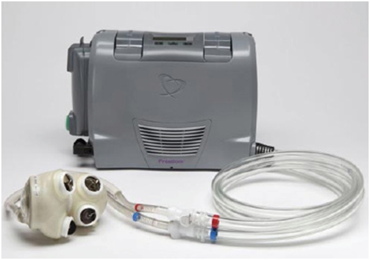 装一颗机械心脏会怎样 - 知乎