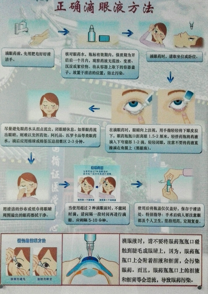 最正确的滴眼药水操作步骤是怎样的？ 知乎