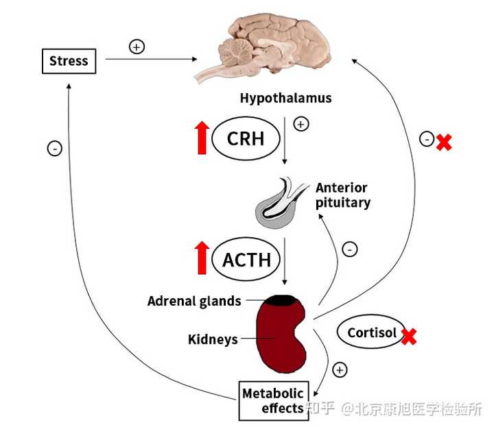 CAH 是什么疾病？ - 知乎