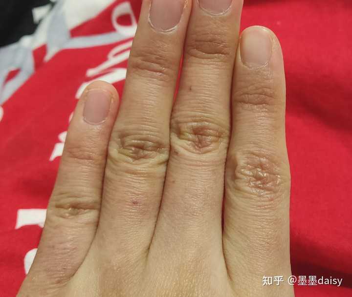有没有让皮肤变好的小习惯? 知乎