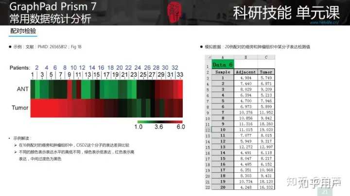医学统计分析绘图，只用Graphpad prism，和SPSS统计后再Graphpad绘图，有何差别？ - 知乎