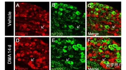 TRPV1和NF200的关系是什么？ - 知乎