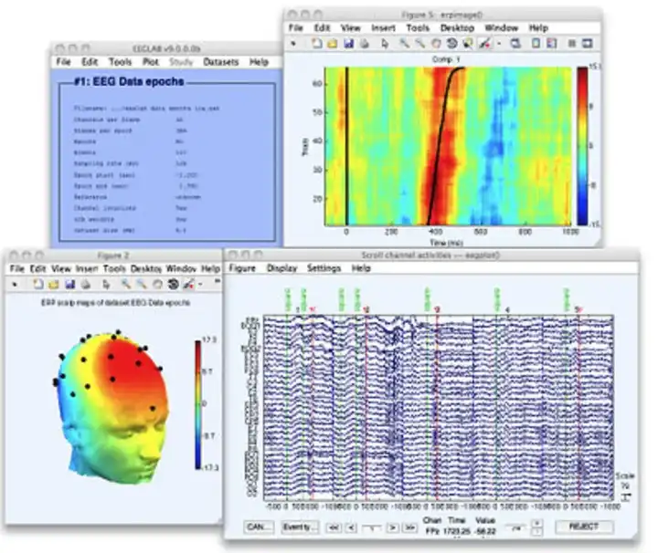 研一，老师方向是脑机接口，让自学EEG 我现在自学了eeglab的预处理，接下来应该学习什么？ - 知乎