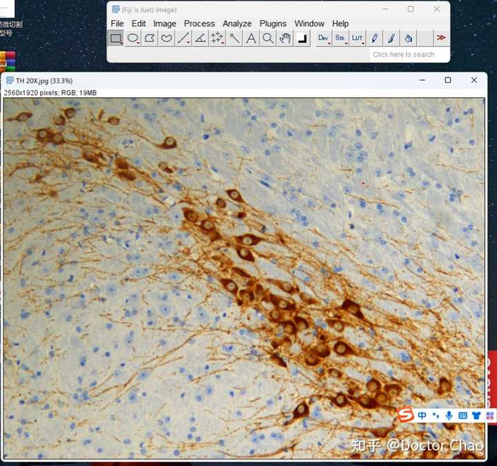 用imagej 免疫组化及荧光强度的分析？ - 知乎