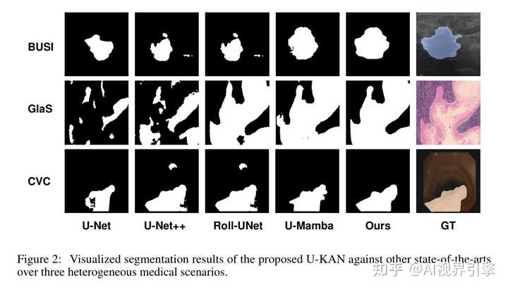 skip connection的原理是什么？为什么U-net中要用到skip connection? - 知乎