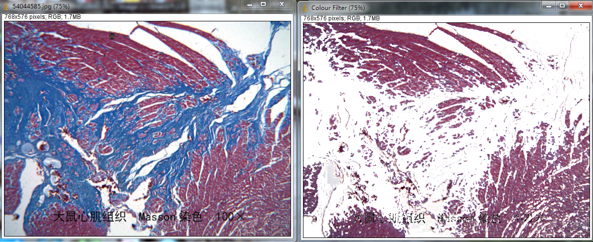 Imagej图像处理实践（ImageJ学习-图像处理 545367350） - 知乎