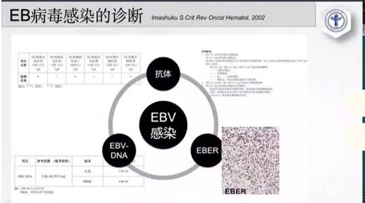 EB病毒抗体、EB病毒DNA载量、组织EBER检测结果的分类解释 - 知乎