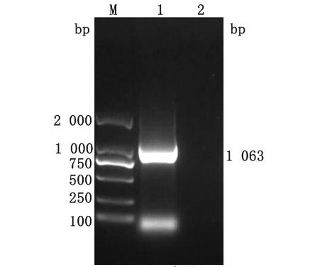 鉴定猪流行性腹泻病毒纤突蛋白受体结合区（PEDV-RBD）重组蛋白免疫原性的实验操作流程 - 知乎