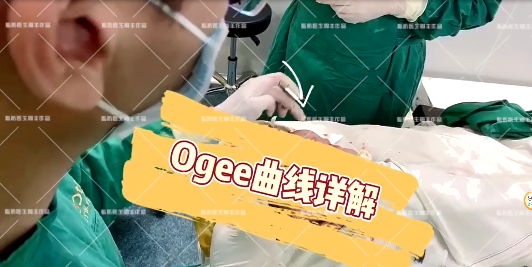 周丰脂肪填充： 如何定制面部高光点的神韵？-Ogee曲线详解【脂肪填充+苹果肌复原】 - 知乎