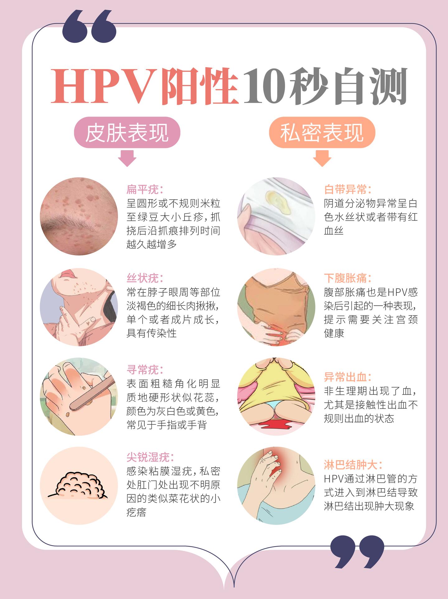 如何自测HPV? HPV阳性10秒自测，快收藏！ - 知乎