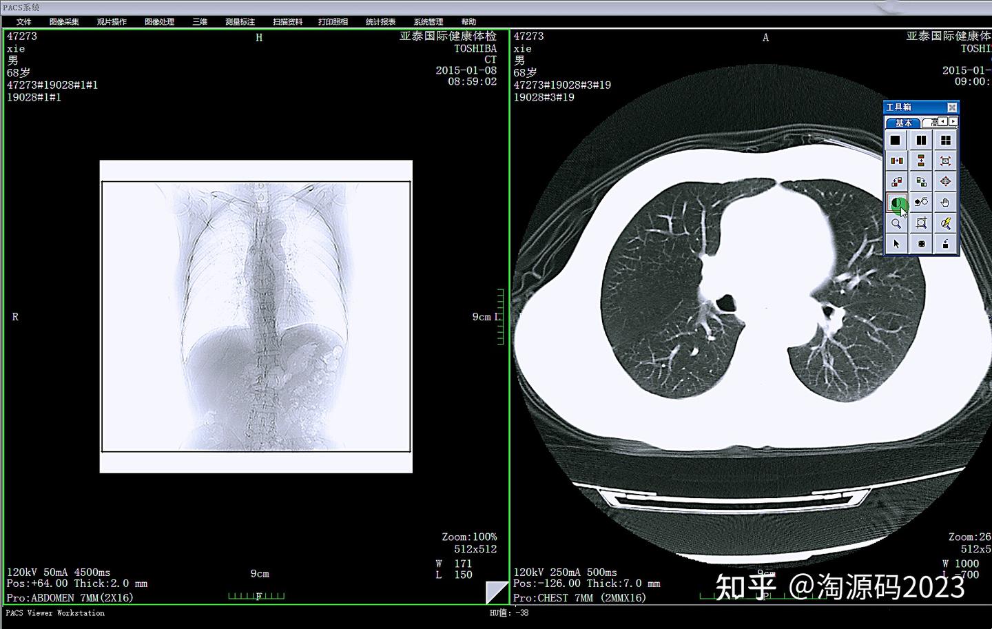 医学影像系统源码（MRI、CT三维重建） - 知乎