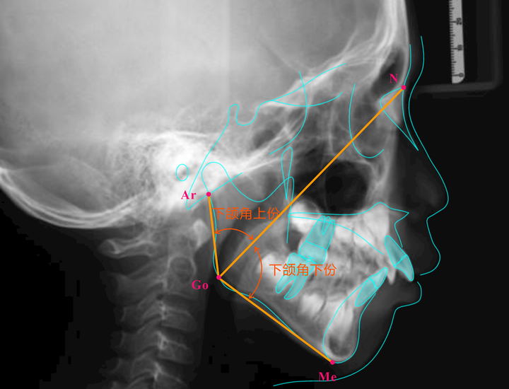 Jarabak 分析法 - 知乎