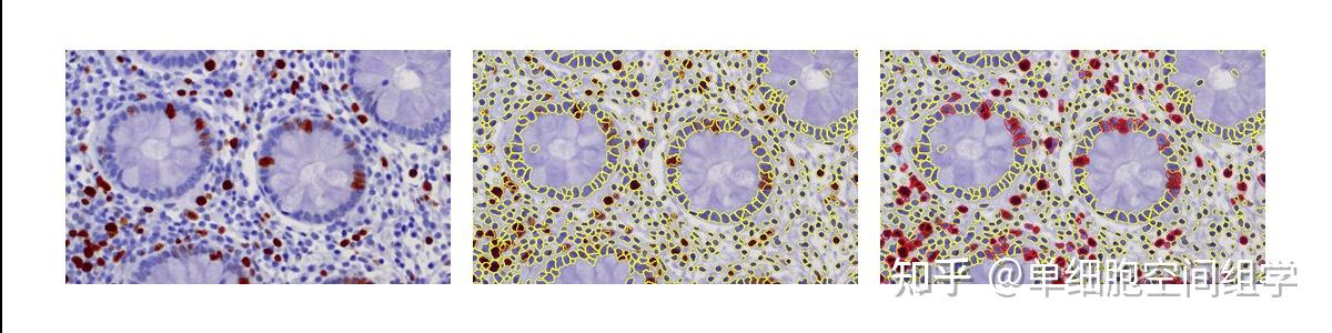 多组学数据标准的验证利器分享——TissueFAXS Cytometry技术 - 知乎