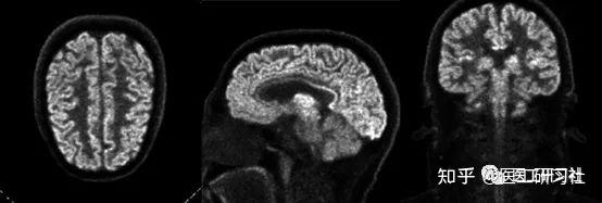 联影医疗PET/CT：不仅仅是中国第一 - 知乎