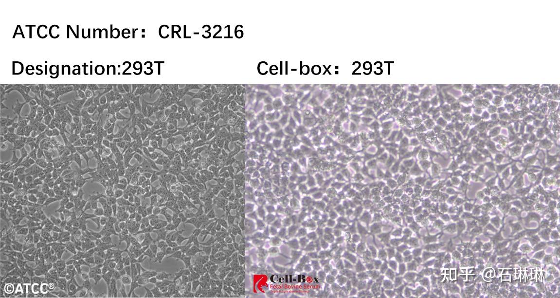 关于293T细胞培养的那些事 - 知乎