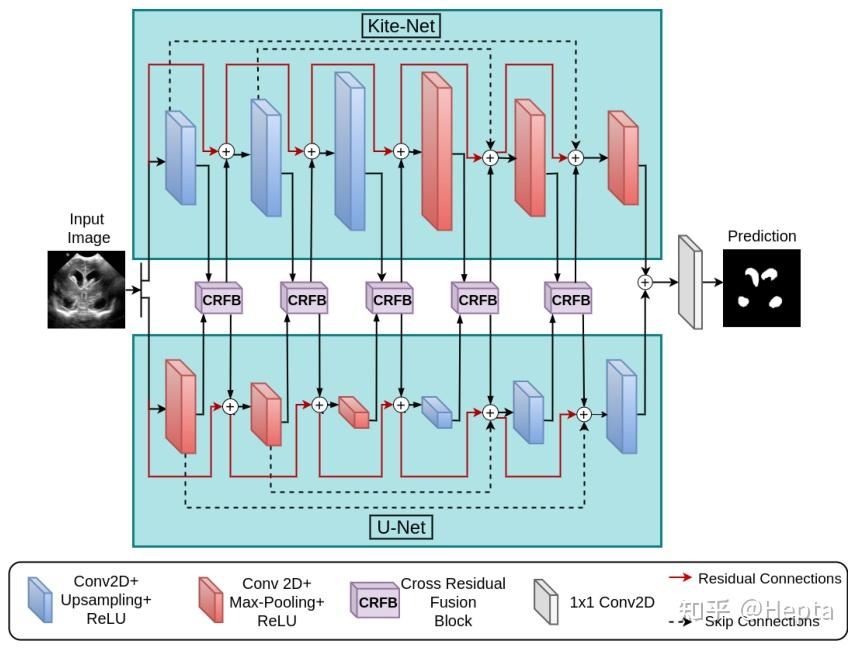 2021 Review: U-Net Family | U-Net 家族新的一些进展 - 知乎