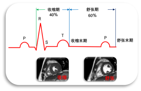 MRI 的ECG解读 - 知乎