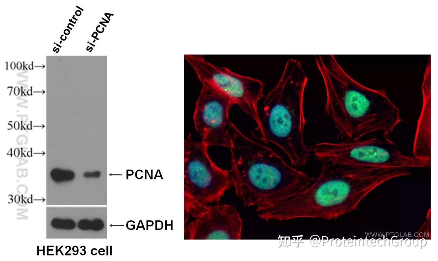 WB指南 | 18种常用WB内参大盘点！码住！ - 知乎