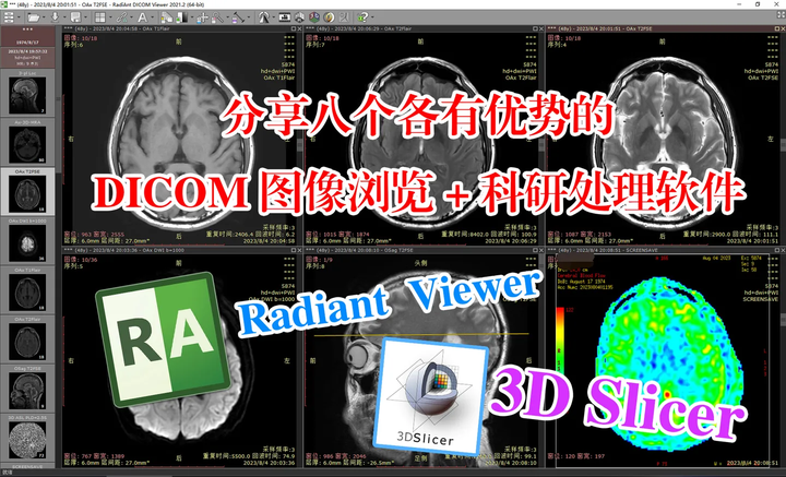 Dicom 图像浏览器和影像科研平台推荐(附 Radiant Viewer、3d Slicer 安装包) 知乎