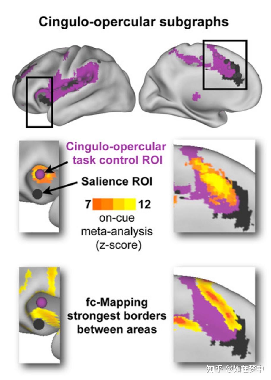 脑网络简介 - 知乎