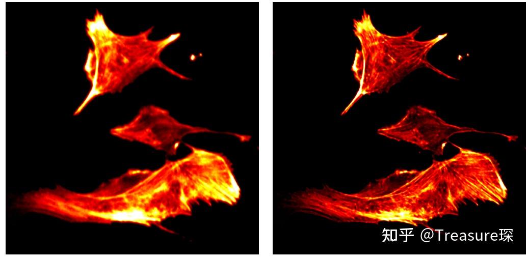 ImageJ实用教程——DeepImageJ（插件篇） - 知乎