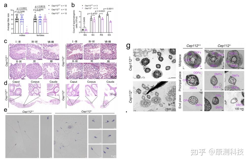 NC|男性不育新机制：CEP112突变损害相分离和必需生育mRNA的翻译 - 知乎