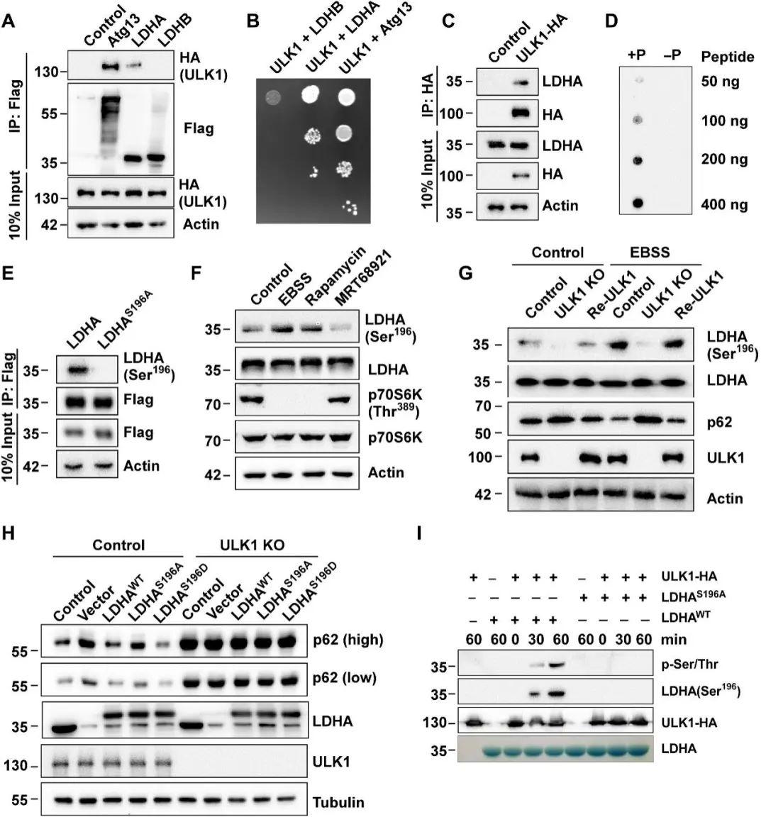 Sci Adv | 华东理工大学团队报道Vps34乳酸化修饰调控细胞自噬 - 知乎