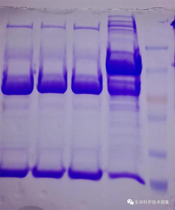 Native PAGE及切胶回收纯化实验方法 - 知乎