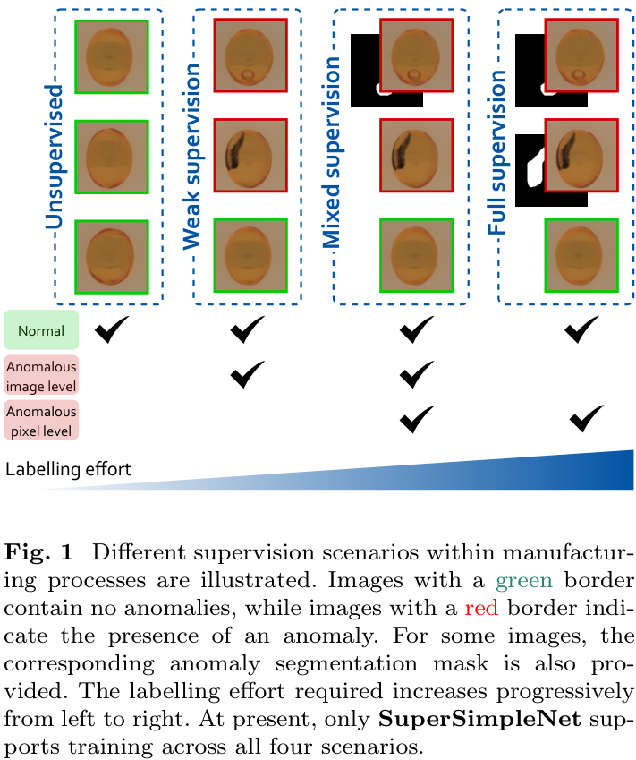 SuperSimpleNet: 不再浪费任何一张标签！首个统一所有监督范式的表面缺陷检测模型 - 知乎