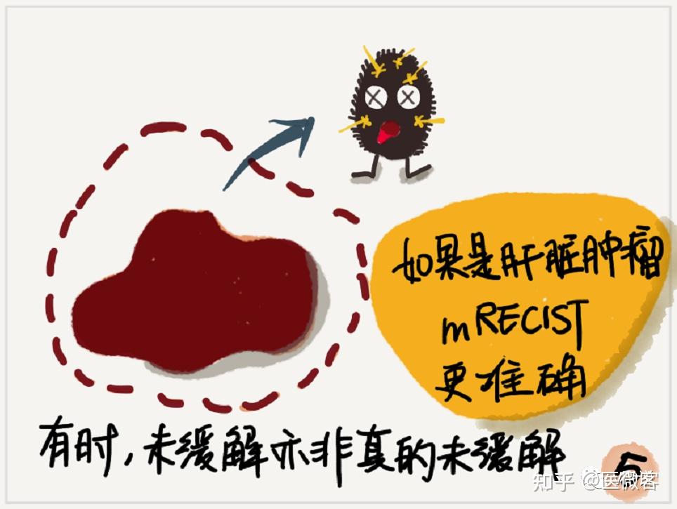 浅谈肿瘤疗效评价的新标准---irRC、iRECIST、ImRECIST - 知乎