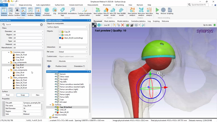 Simpleware X-2025.06 新版发布：创建用户的 CAD 器械库和持续推进自动化 - 知乎