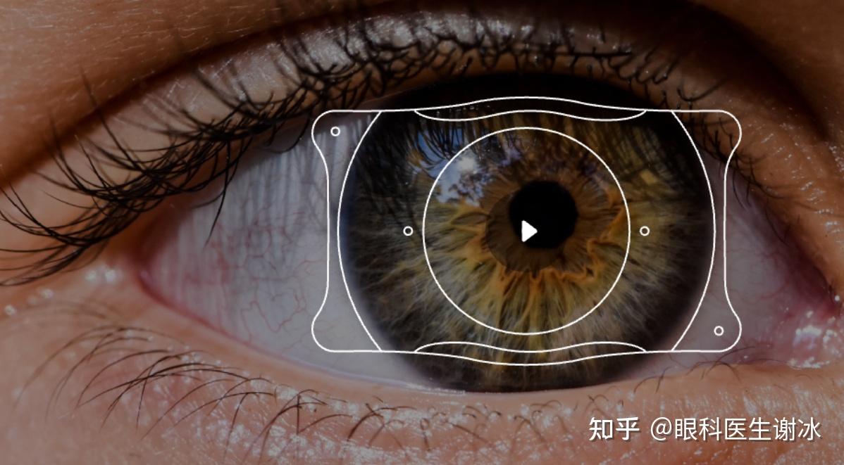 icl晶体v5比icl v4c是不是视觉效果好不少？有做过的iclv5的朋友分享一下吗？谢谢? - 知乎