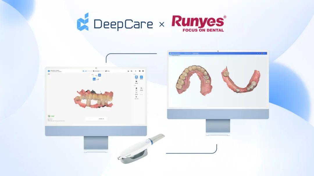 DeepCare羽医甘蓝与Runyes蓝野医疗完成全球数据集成 - 知乎