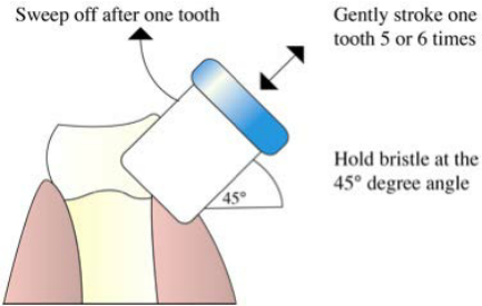 电动牙刷是不是也该用巴氏刷牙法？ - 知乎
