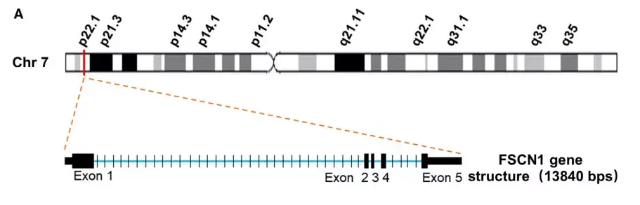 杰享第08期：肌动蛋白结合蛋白1（FSCN1）:潜力生物标志物及药物开发靶点？ - 知乎