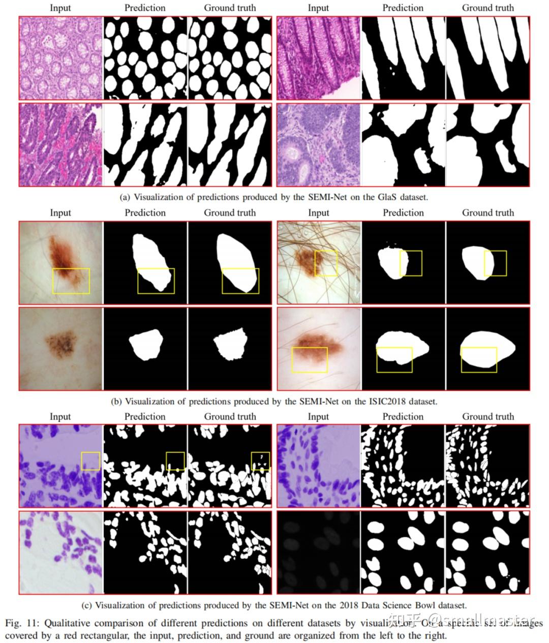 佛罗里达理工提出seUNet | 融合CNN和ViT成就简单而又高效的UNet-Transformer - 知乎