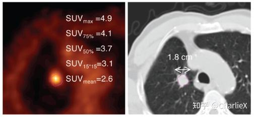 Partial Volume Effect（部分容积效应） - 知乎