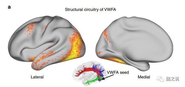 Nature communications：VWFA，一个集语言与注意于一身的脑区 - 知乎