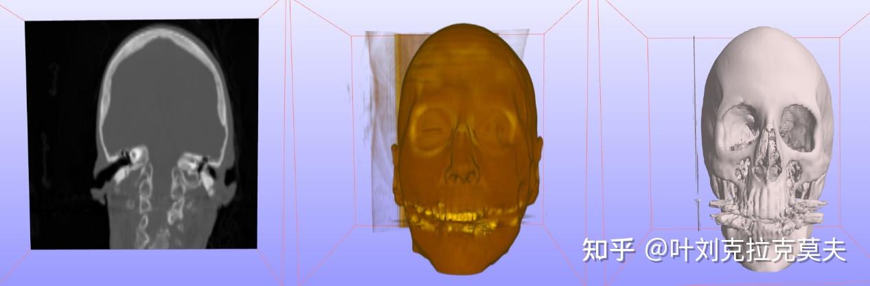 开源科学工程技术软件介绍15 – 生物力学有限元分析软件FEBio和FEBio Studio - 知乎