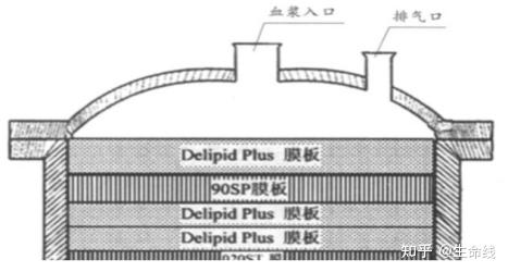 血脂异常新疗法，DELP新型体外血脂分离技术 - 知乎