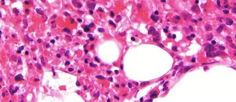 【CTB-488/CTB-555】霍乱毒素B亚基（CTB示踪剂） - 知乎