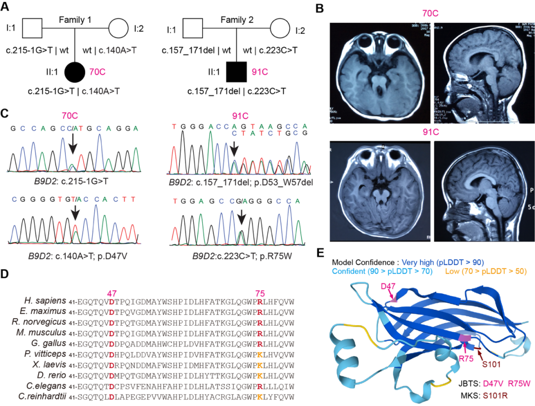 IF=13.6！上海交通大学曹木青老师团队新突破：B9复合体双功能解析，揭示纤毛病(JBTS/MKS)的分子分水岭！ - 知乎