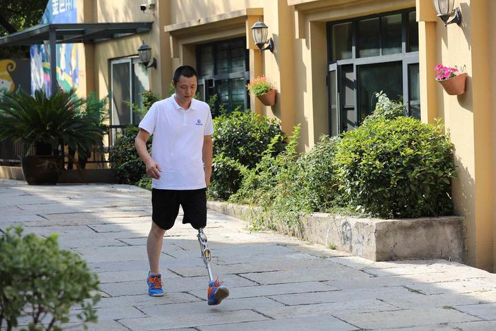 残肢长度及围长测量方法详解 知乎