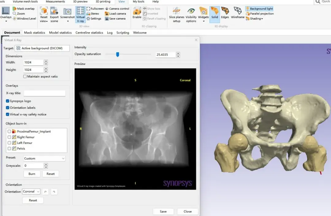 【Simpleware 手册】X 射线 - 知乎