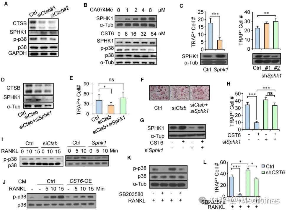 引文集锦丨Theranostics：中国科学院胡国宏团队研究揭示CST6通过抑制CTSB活性和破骨细胞形成来抑制乳腺癌骨转移 - 知乎