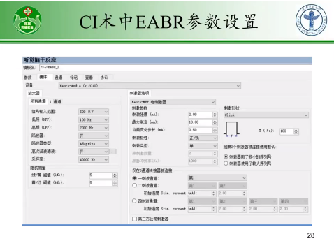 临床听力学技术专业沙龙｜人工耳蜗植入术中及术后EABR的应用 - 知乎