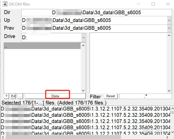 SPM数据预处理 -单被试 - 知乎
