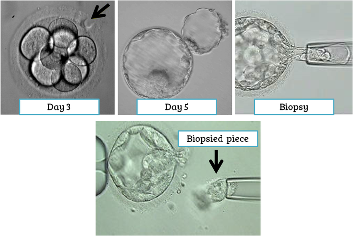 PGS 测试完整指南 (PGT-A) - 知乎