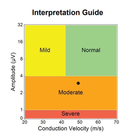 医疗科技评论 | 便携式无创神经传导测量仪DPNCheck用于评估糖尿病周围神经病变 - 知乎